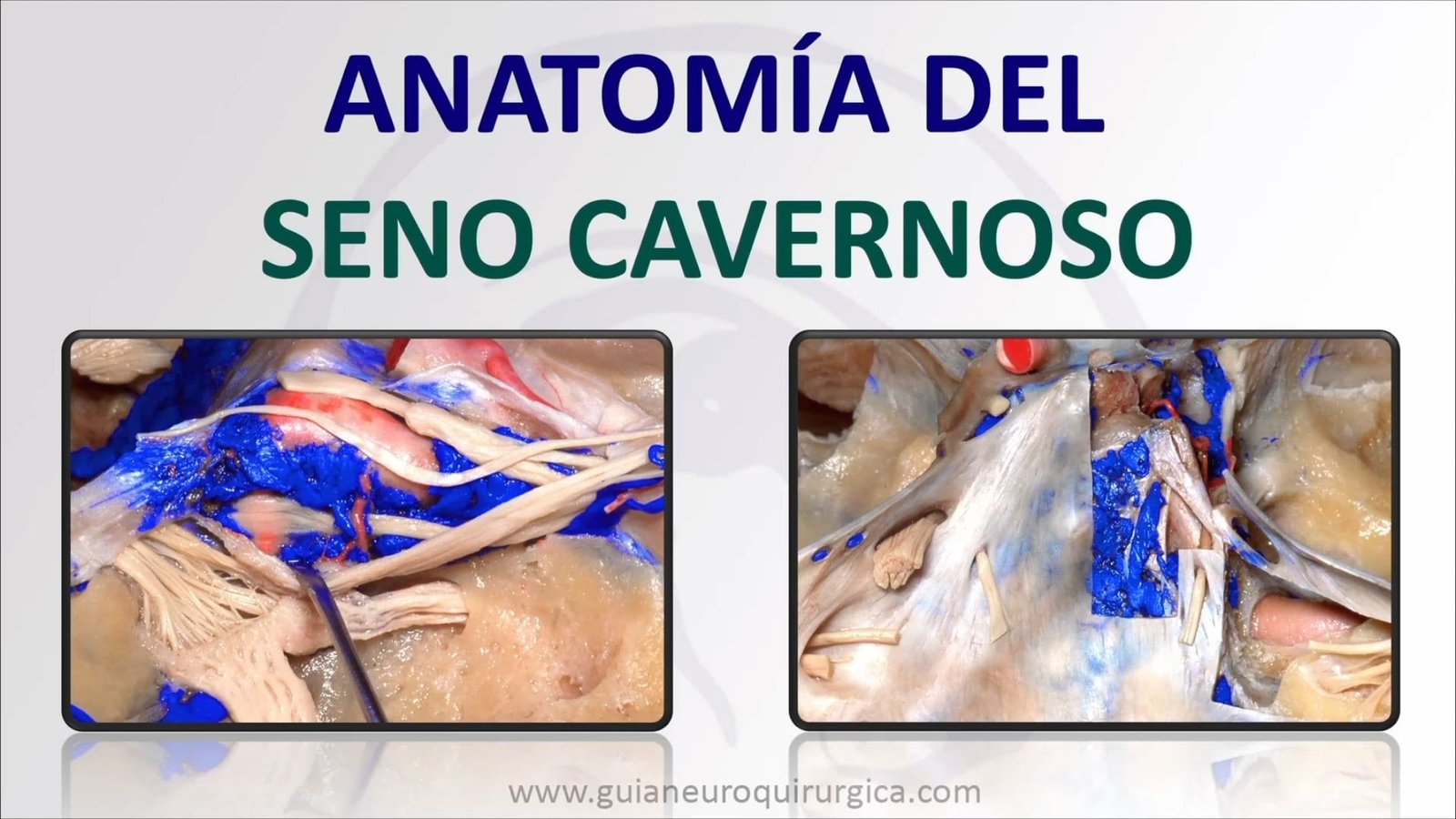 Guía Neuroquirúrgica - Guía Neuroquirúrgica | Neuroanatomía | Álvaro ...